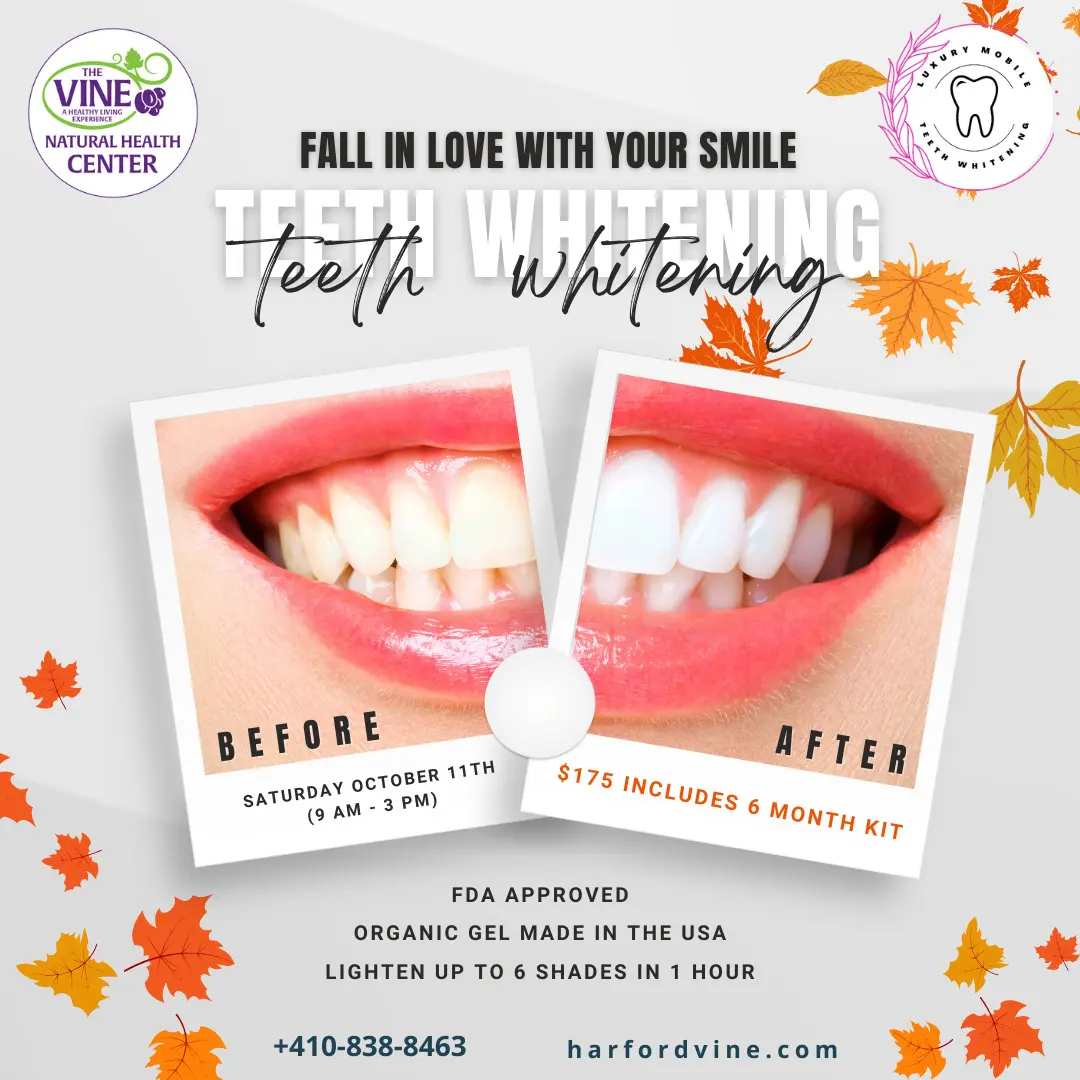 Fall In Love With Your Smile: Teeth Whitening - The Vine Natural Health ...