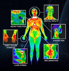 Thermography - The Vine Natural Health Center